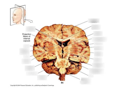 Week 2 Neuro Anatomy Brain Coronal Section Diagram Quizlet