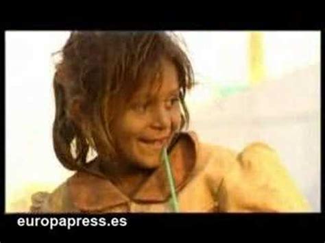 Millones de niños menores de 5 años mueren por desnutrición YouTube