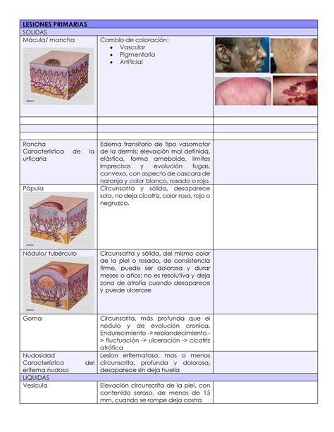 Lesiones Elementales Dermatologia LESIONES PRIMARIAS SOLIDAS Mácula