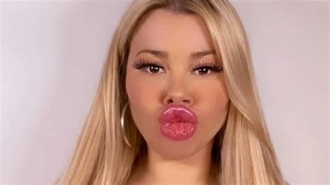 Bimbofication To 2000cc Implants A Personal Causes Crowdfunding Project In London By Dolly