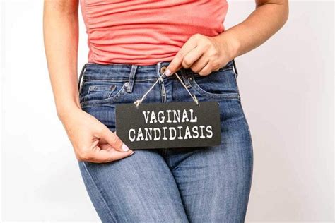 5 Remedios Alternativos Para Combatir La Candidiasis Vaginal Mejor