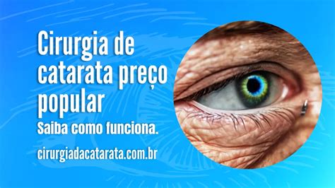 Cirurgia de catarata preço popular vale a pena