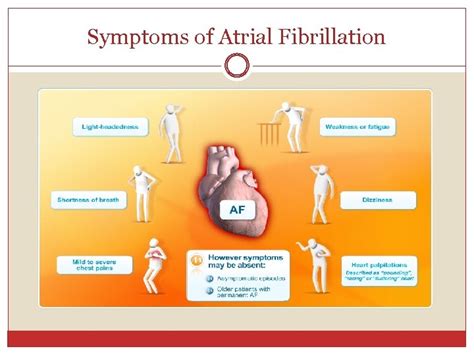 Atrial Fibrillation RACHEAL JAMES HEART RHYTHM SPECIALIST NURSE
