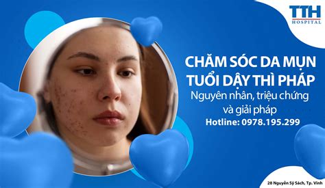 Chăm sóc da mụn tuổi dậy thì Nguyên nhân triệu chứng và giải pháp