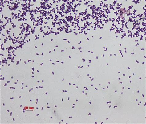Chemoorganotrophs Definition And Examples