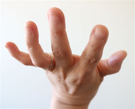 Hand Reference Foreshortening Art Prof Flickr