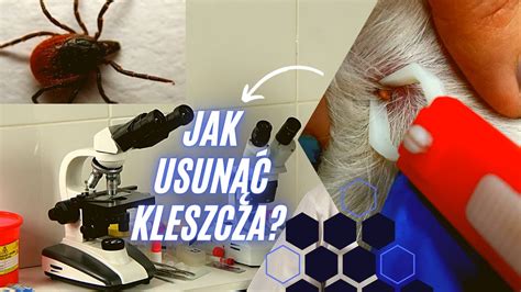 Jak usunąć kleszcza u psa gościnnie dr hab R Welc Falęciak YouTube
