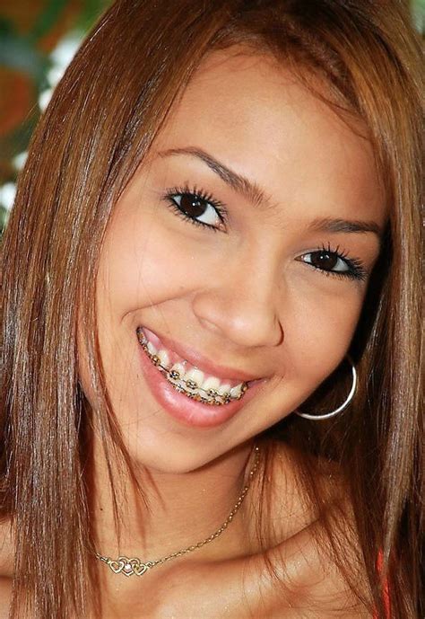 Naked Girl Braces Telegraph