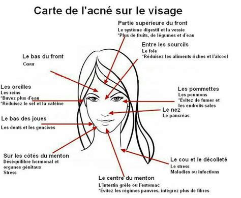 Faire Dispara Tre Les Boutons Face Mapping Face Mapping Acne Face Acne