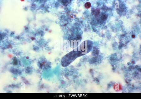 This Photomicrograph Of A Trichrome Stained Specimen Revealed A Mature