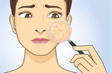 Top 7 Benefits Of Sunflower Oil For Skin Age Defying Beauty Made Easy