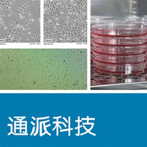 ONCO DG 1细胞甲状腺乳癌细胞培养 细胞株类 通派上海生物科技有限公司