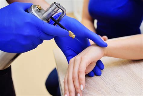 Cryotherapy Clinic Treatment Dorset Bournemouth Christchurch
