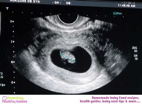 Week Of Pregnancy Pregnancy Week By Week Pregnancy Week By Week