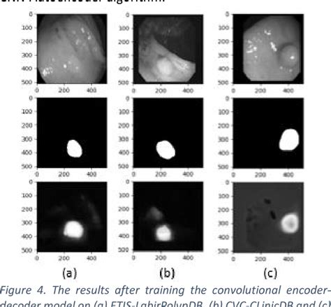 figure 4 from automatic colon polyp detection using convolutional encoder decoder model