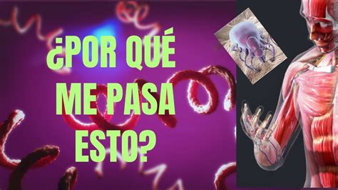 ESTO PASA EN TU CUERPO SI TE PICA UNA GARRAPATA YouTube