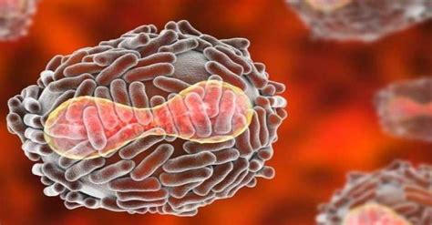 México ha confirmado 147 casos de viruela del mono