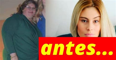 Mãe de Bernardina Brito perdeu 14 QUILOS