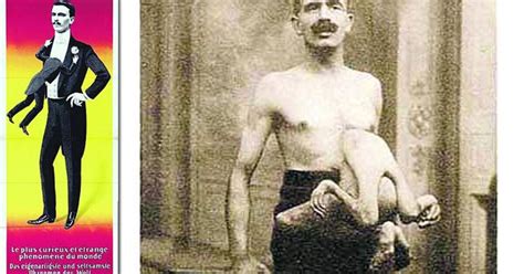 Lhomme Au Double Corps Tout Ce Que Vous Devez Savoir Sur Jean