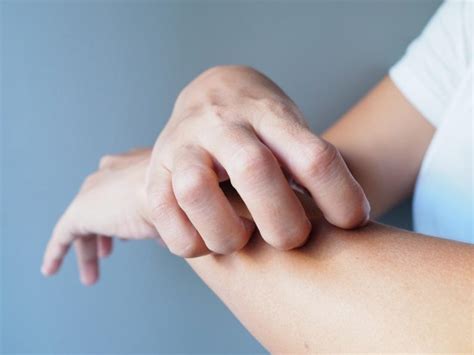 Arquivos Artrite Psoriática COE