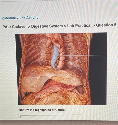 Solved Digestive System Lab Practical Question Chegg