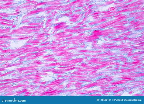 Histología Del Músculo Cardiaco Humano Bajo Opinión Del Microscopio