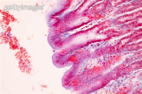 Tissue Of Small Intestine Duodenum Large Intestine Human And Stomach