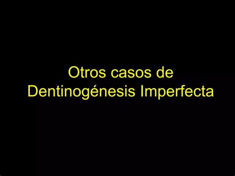 Dentinogénesis Imperfecta PPT Descarga Gratuita