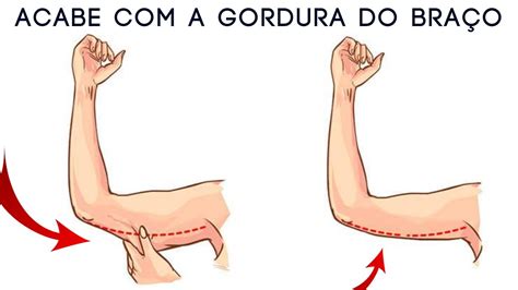 como perder gordura do braço rapidamente TML Totalmente Leve YouTube