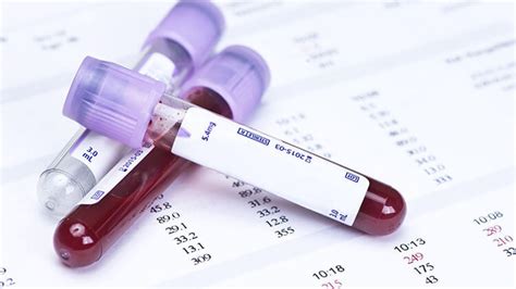 Guía definitiva para entender un análisis de sangre de los hematíes al