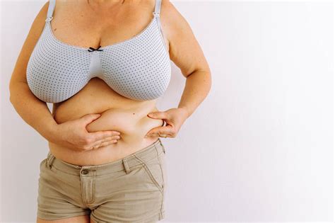 Dra Lorena Rosique Mamoplastia redutora também pode ser realizada por