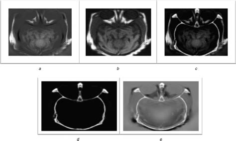 image fusion scheme based on modified dual pulse coupled neural network el‐taweel 2013 iet