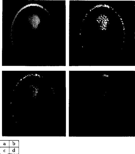 figure 4 from edge preserving map image reconstruction from projections gaussian and poisson