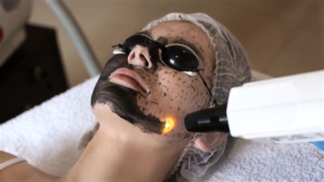 Karbon Peeling Nedir Love Beauty Center