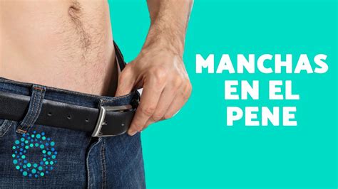 Manchas Oscuras En El Glande Causas Y Tratamientos Sin Dolor Aela Es