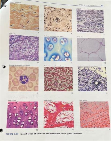 Solved 80 EXERCISE 6 TISTUES E Epithelial And Connective Chegg