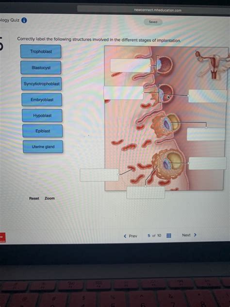 Solved Correctly Label The Following Structures Involved Chegg