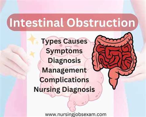 Intestinal Obstruction Types Causes Symptoms Diagnosis Management