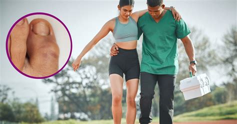 Remedio Para Eliminar Bulto Duro Por Un Golpe Salud180