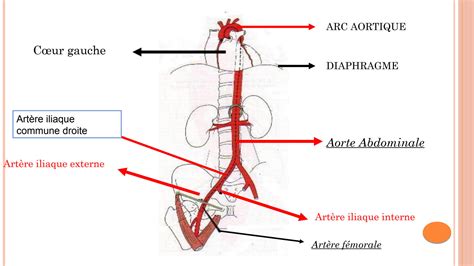 Solution Vascularisation Arterielle Du Membre Inferieur Studypool