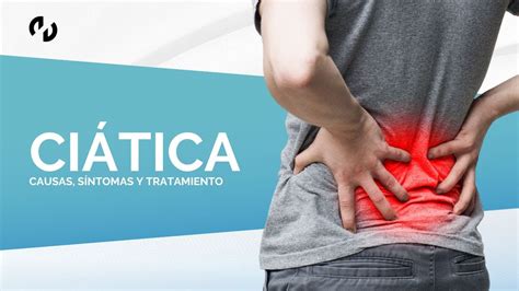 Ciática Qué es causas diagnóstico síntomas y tratamiento YouTube