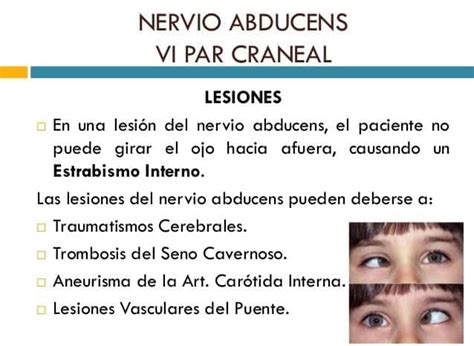 Nervio Abducens anatomia origen real y aparente función y lensión