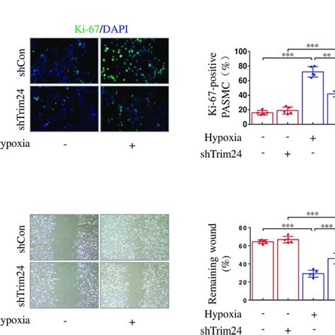 Silencing TRIM24 Inhibits Hypoxia Induced Proliferation And Migration