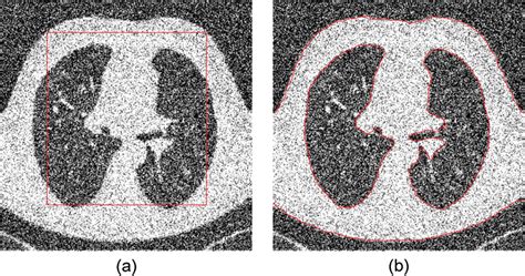 active contour segmentation a original image with initial contour b download scientific