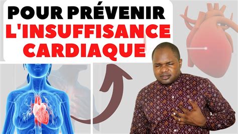 Insuffisance Cardiaque D Finition Sympt Mes Causes Et Pr Vention