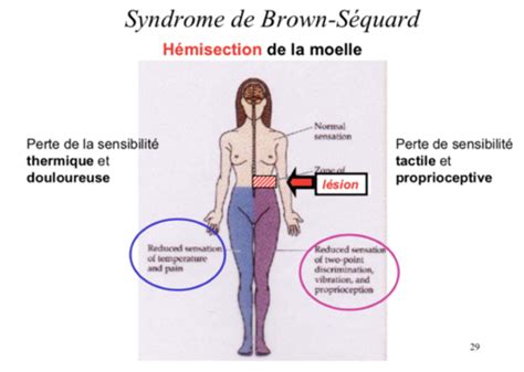 Physiologie Nerveuse 3 Flashcards Quizlet
