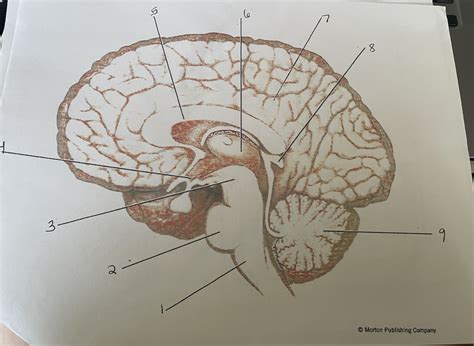 Brian Diagram Diagram Quizlet