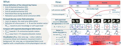cmr phase detection