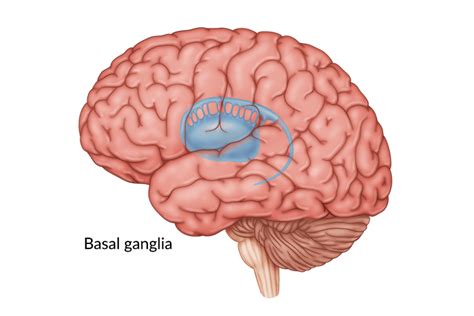 Basal Ganglia Stroke What To Expect How To Recover