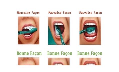 Comment bien se brosser les dents vidéo Source Shop